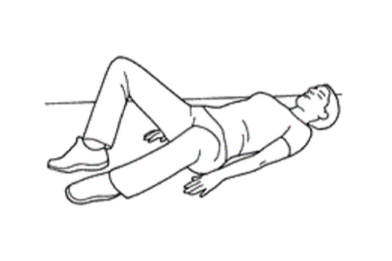 Diastasis Recti - Symptoms, Treatment, And Exercises